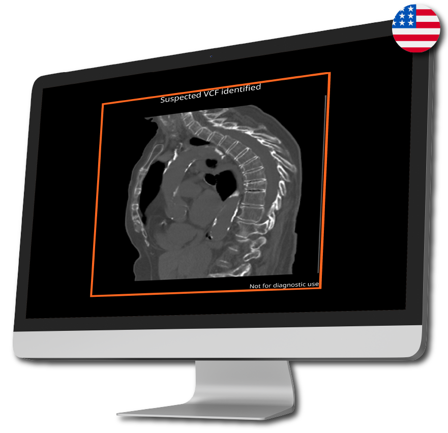 Avicenna.AI - Empowering Radiology With AI-based Tools